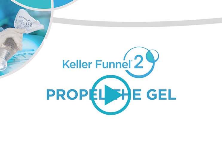 keller funnel uk